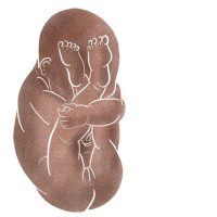 OptiBreech – Optimising care and options for women with a breech ...